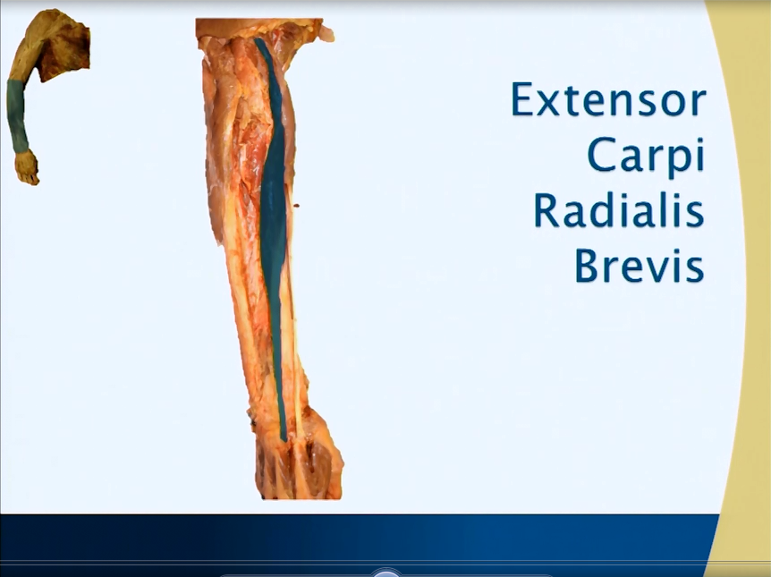 Muscle Chart: Extensor Carpi Radialis Brevis (Antebrachium - Forearm ...