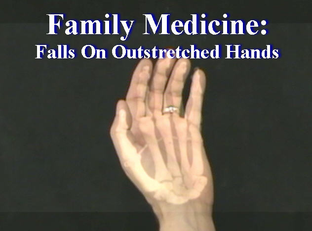 Family Medicine: Falls On Outstretched Hands - Anatomy Guy