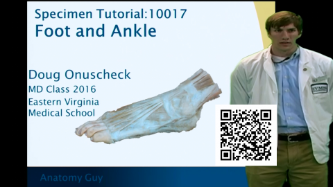 slap foot gait Archives - Anatomy Guy