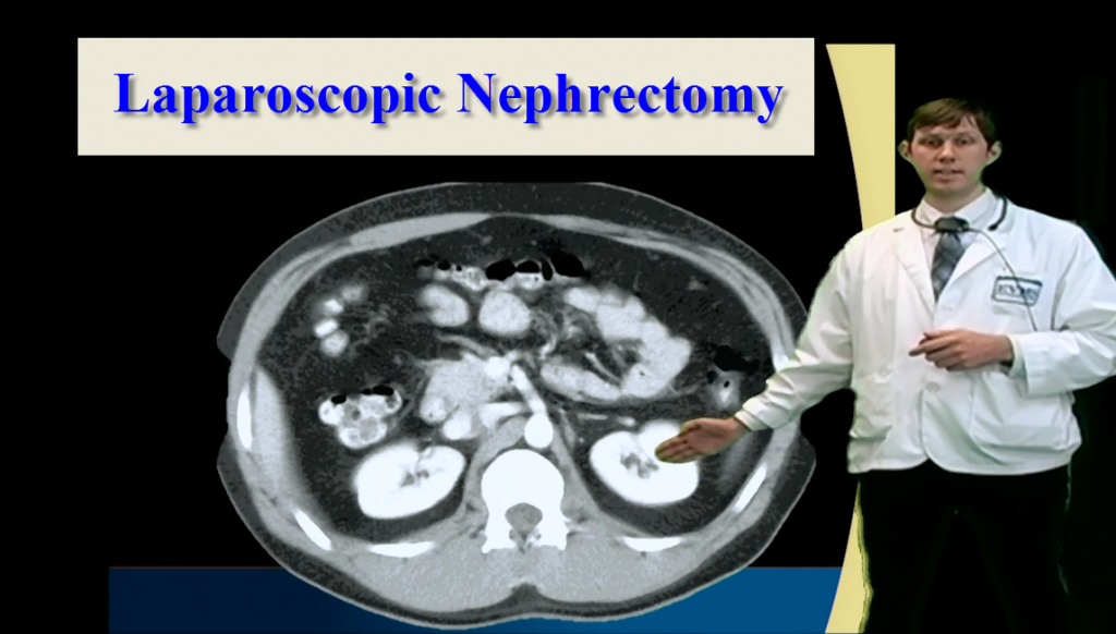 retroperitoneal laparoscopy Archives - Anatomy Guy