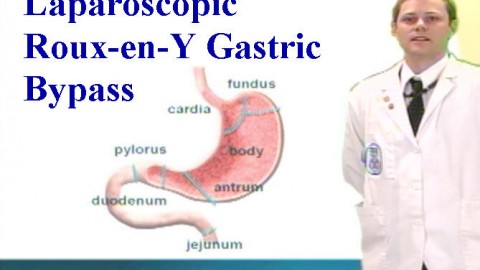 roux-en-y procedure Archives - Anatomy Guy