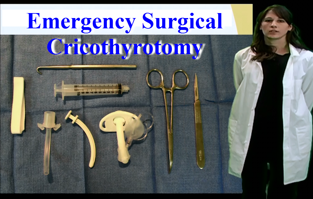Emergency Surgical Cricothyrotomy - Anatomy Guy