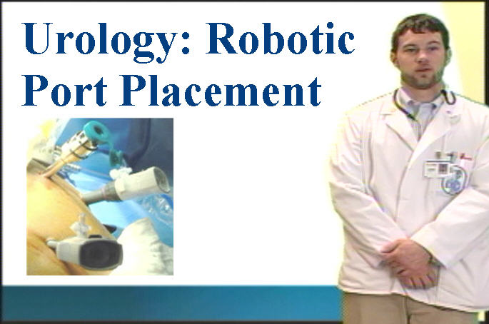 Urology: Robotic Port Placement for Common Urologic Procedures - Anatomy Guy
