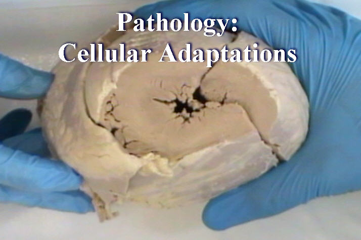Pathology: Cellular Adaptations - Anatomy Guy