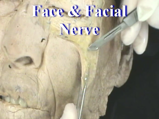 Dissection: Face & Facial Nerve - Anatomy Guy
