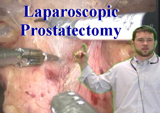 Urology: Robotic Assisted Laparoscopic Prostatectomy - Anatomy Guy