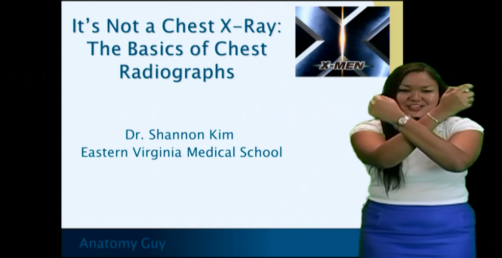 Basics of Chest Radiographs - Anatomy Guy