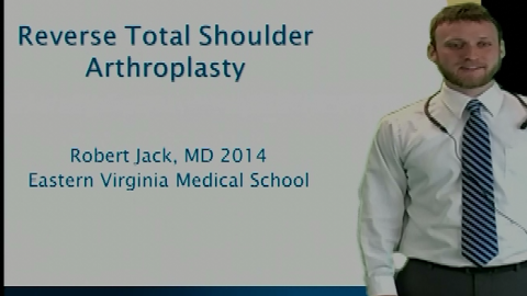 reverse total shoulder arthroplasty Archives - Anatomy Guy