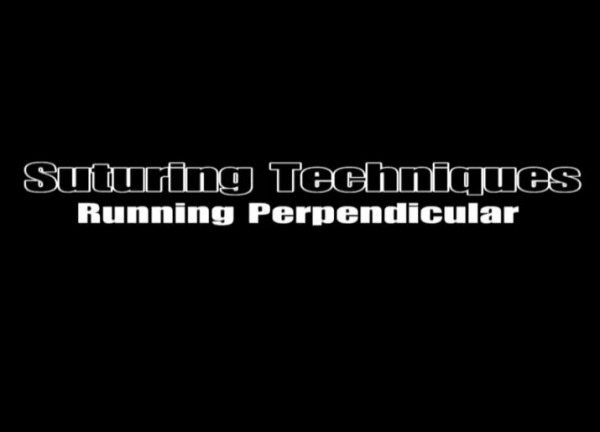 running perpendicular - Anatomy Guy